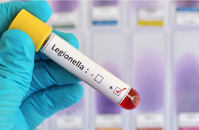 Legionella Risk Assessment | Stay Compliant & Protect Lives